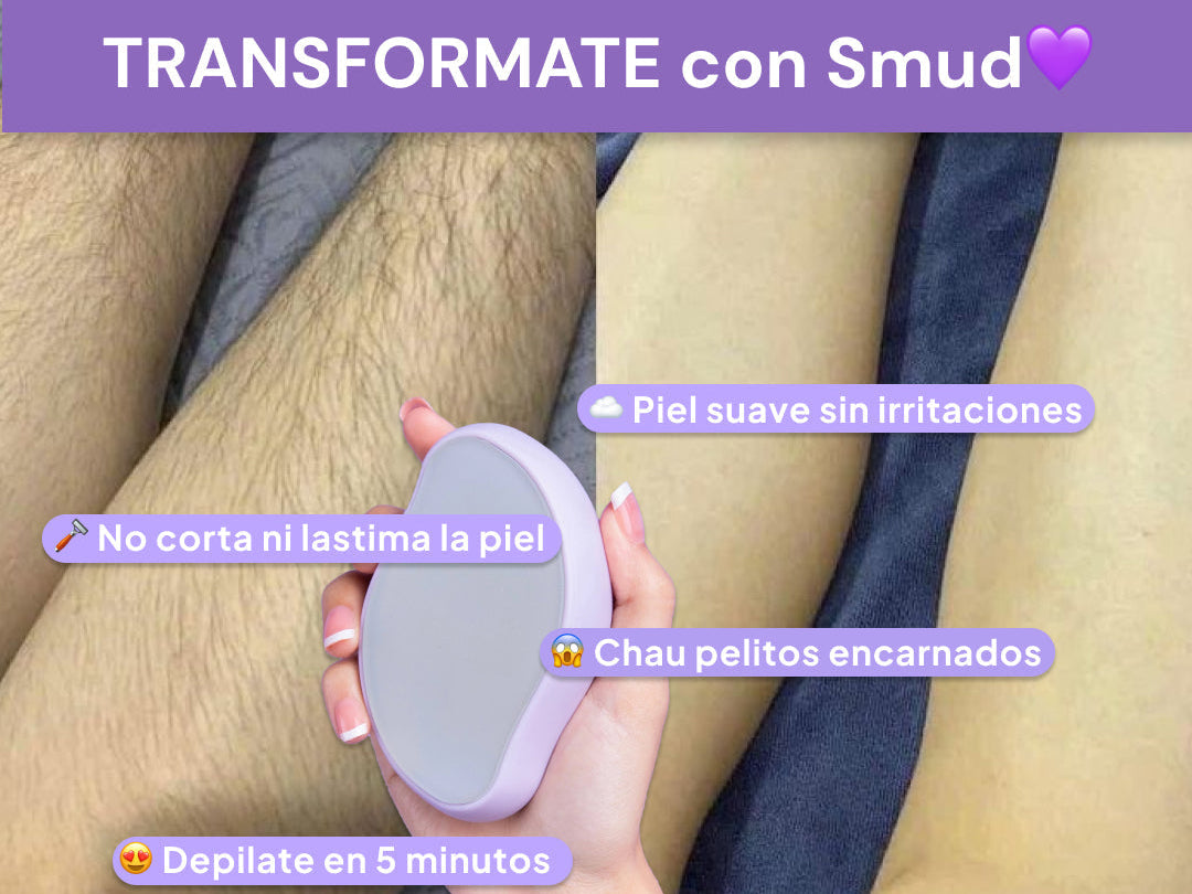 ¿Cómo Funciona Smud?